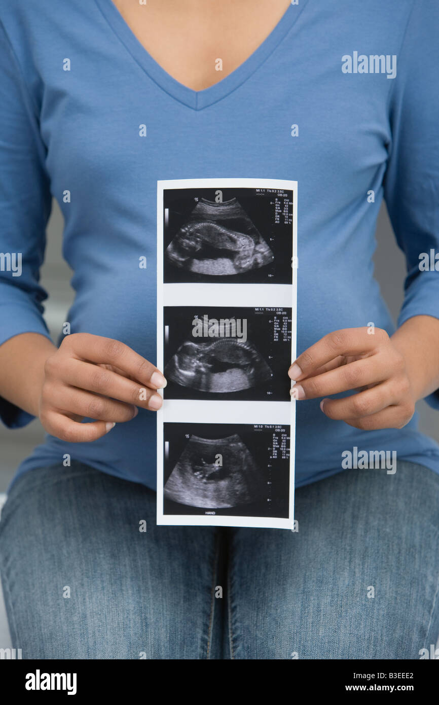 A pregnant woman holding a scan Stock Photo - Alamy