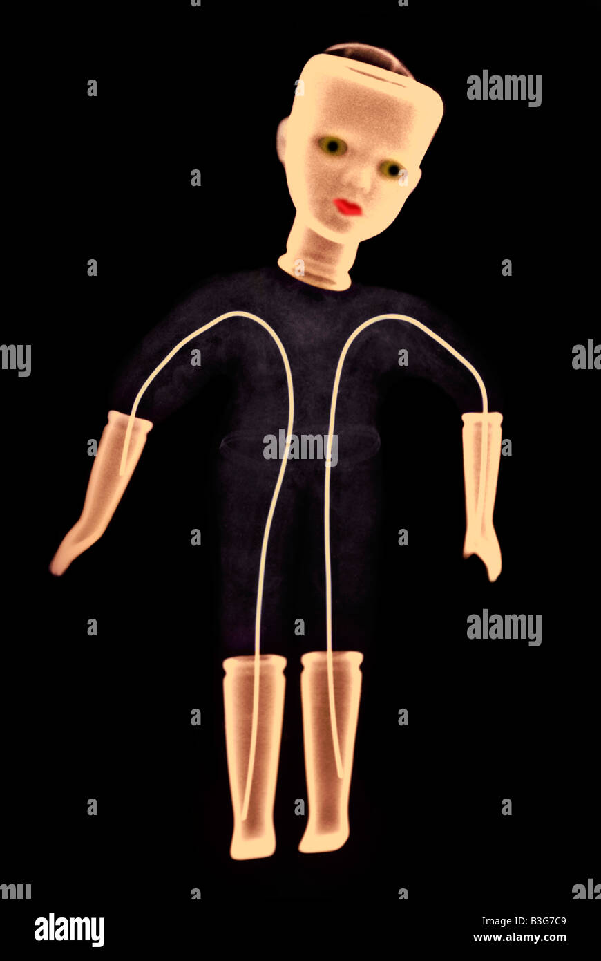 colour enhanced x-ray of a child's doll Stock Photo - Alamy