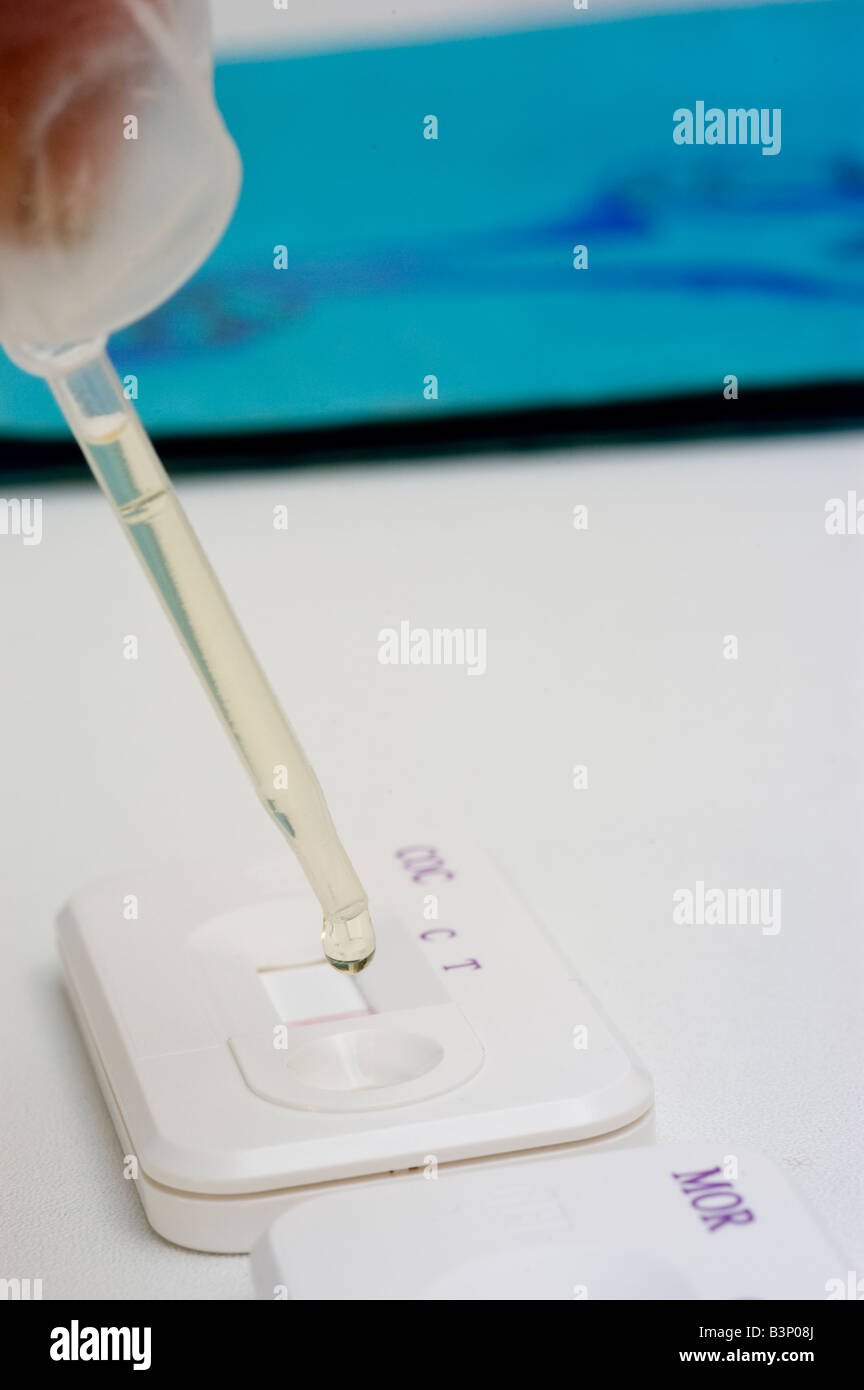 Testing prison inmates urine for cocaine and heroin Stock Photo - Alamy