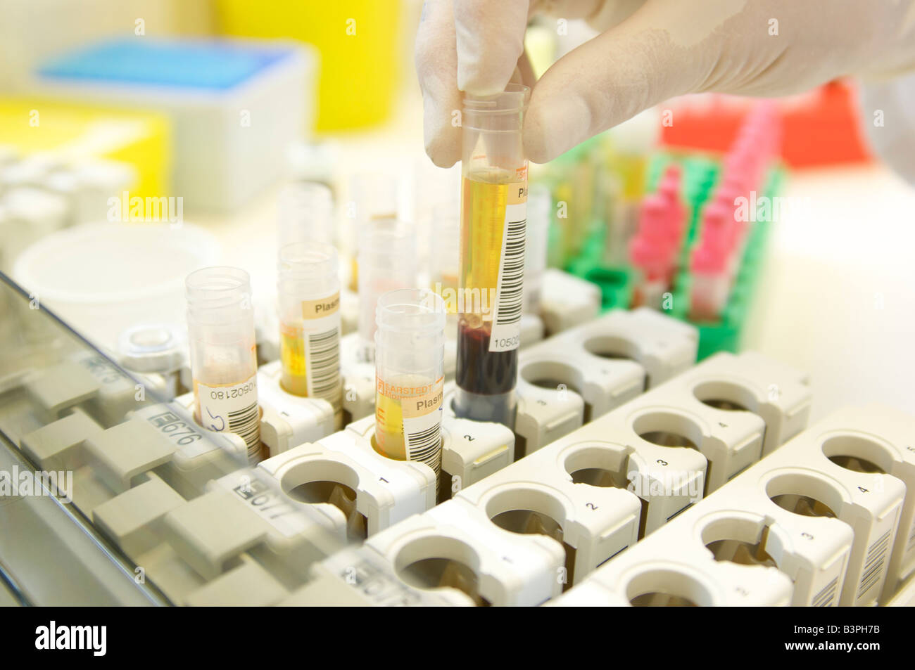 Hand in a sterile glove taking a tube of blood with a barcode from a ...