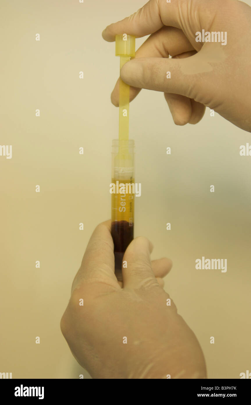 Hand in a sterile glove separating serum from a tube of blood in a ...