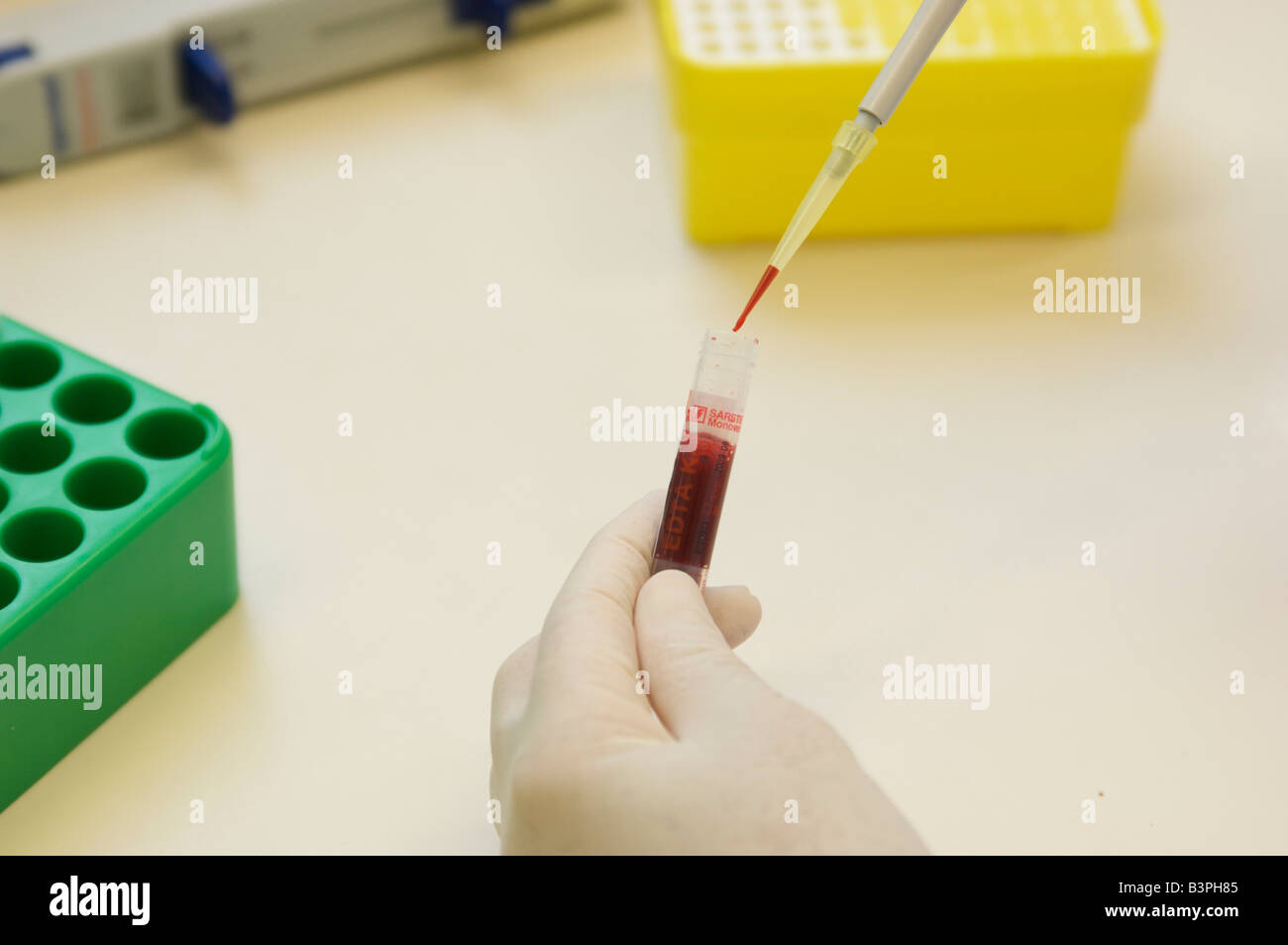 Hand in a sterile glove pipetting a tube of blood with a pipettor in a ...