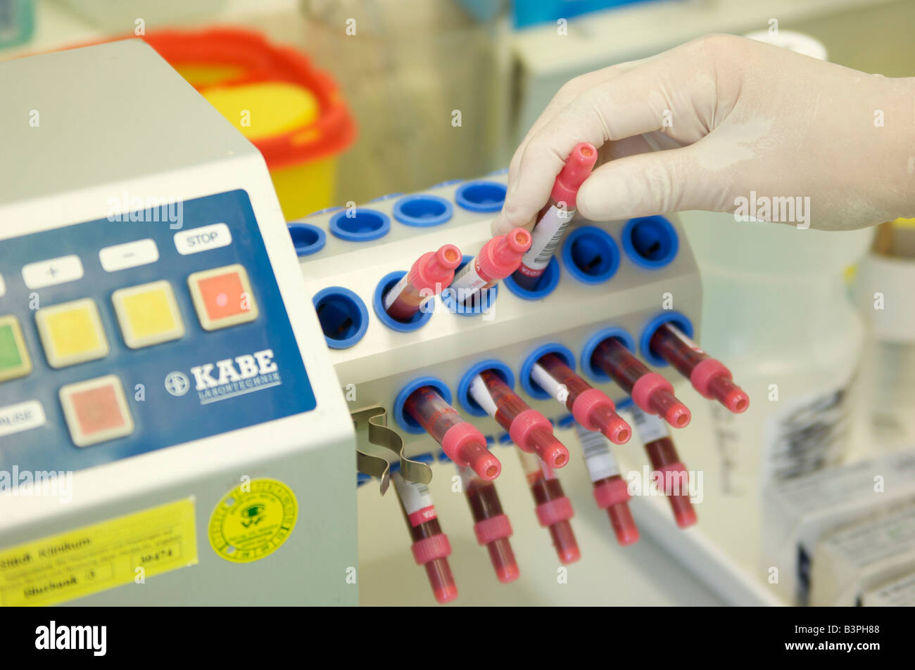 Capillary blood tools hi-res stock photography and images - Alamy