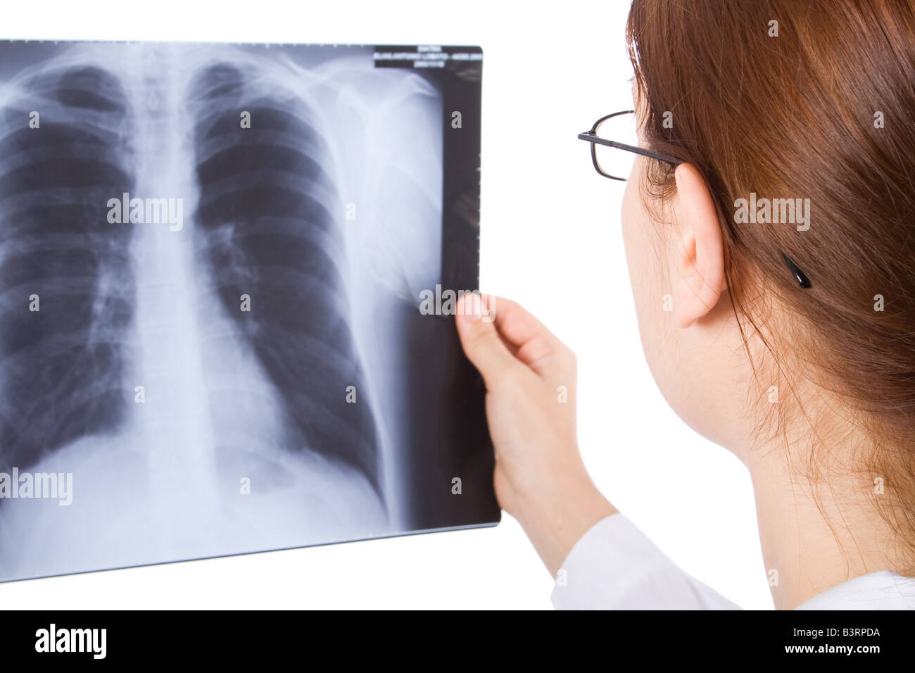 Female thorax anatomy hi-res stock photography and images - Alamy