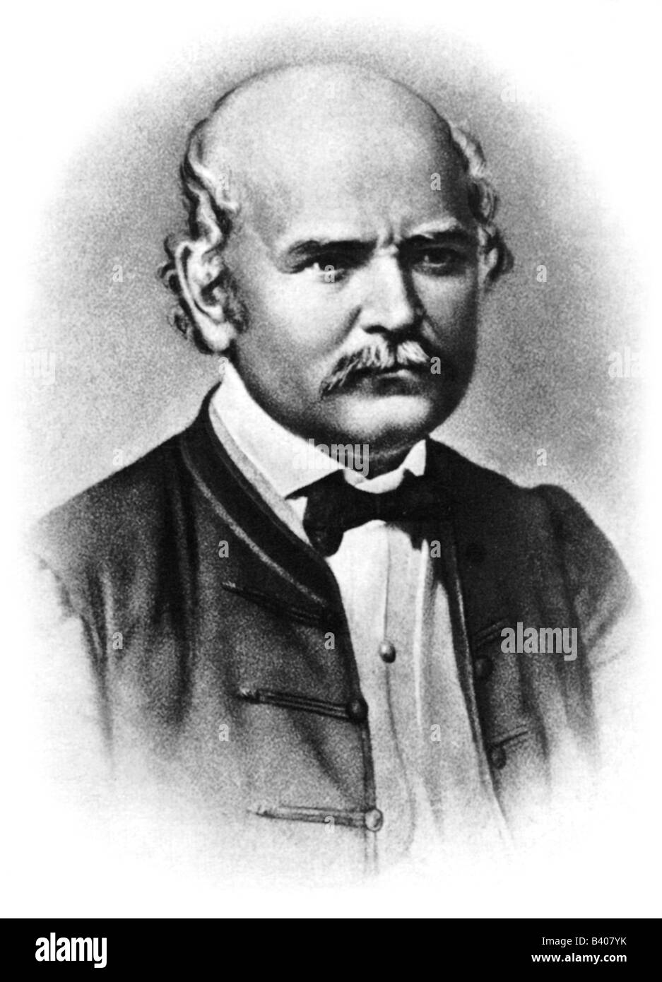 Ignaz semmelweis hi-res stock photography and images - Alamy
