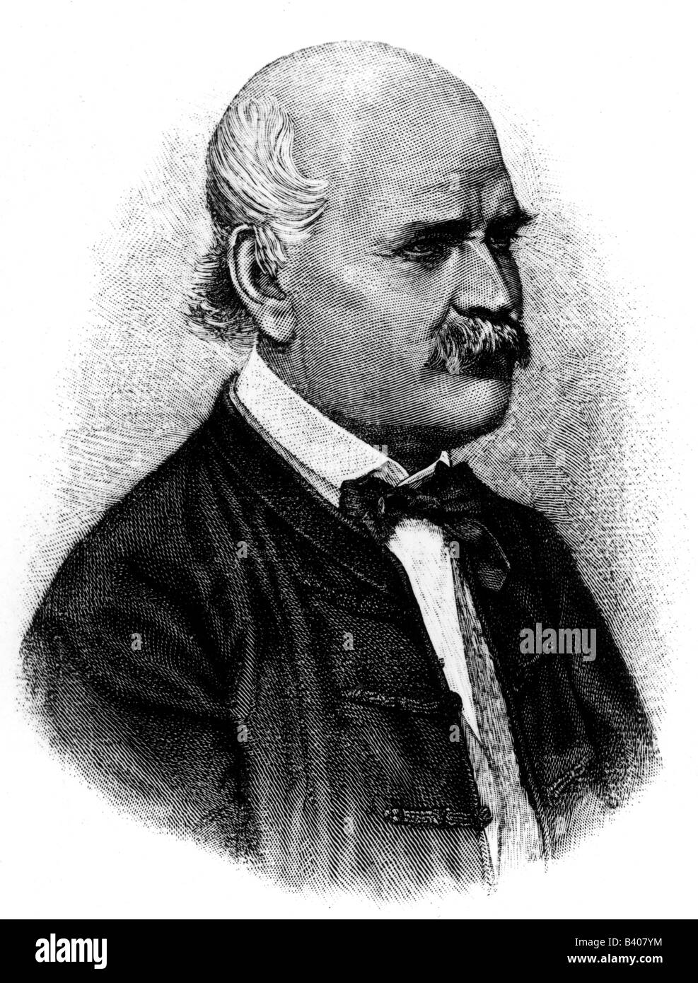 Ignaz semmelweis hi-res stock photography and images - Alamy