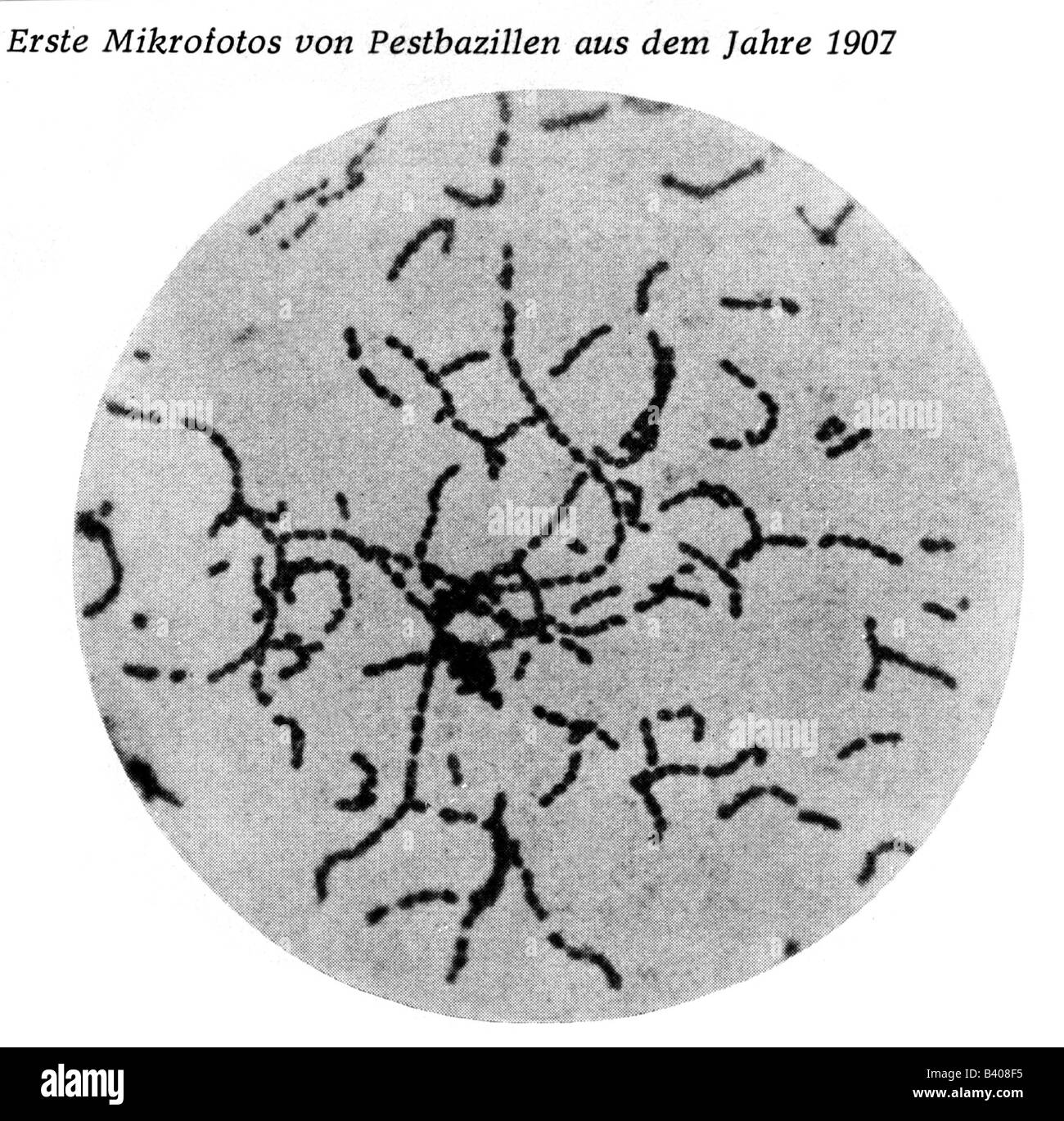 medicine, disease, plague, bacteria Yersinia pestis, microphotograph ...
