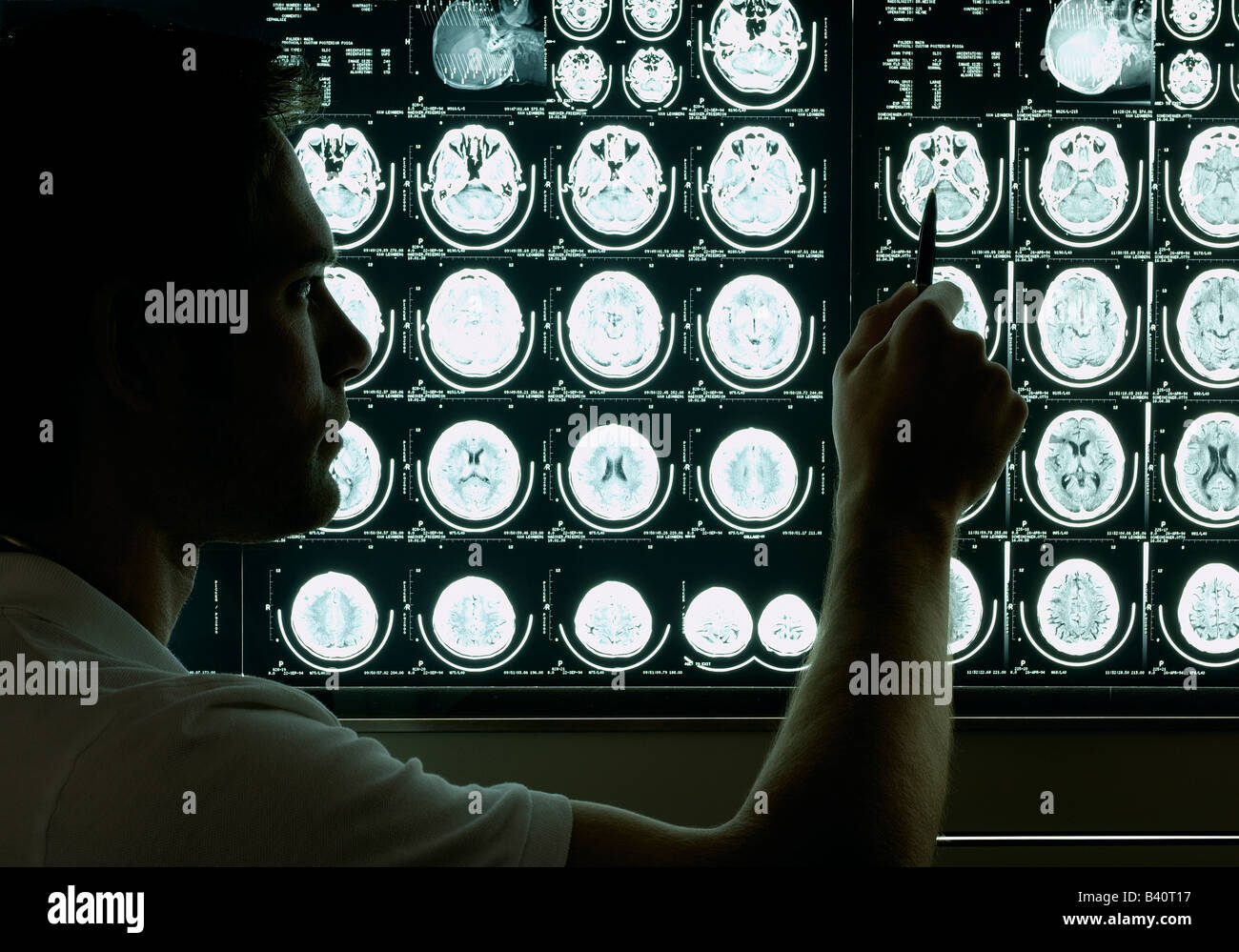 Doctor examining CAT scans on light box Stock Photo - Alamy