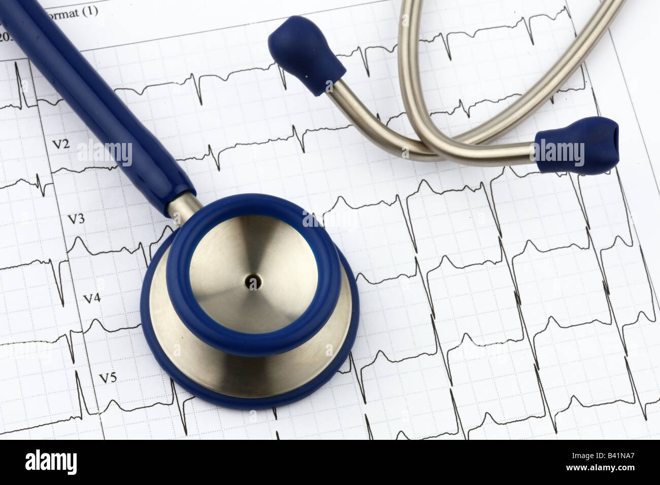 Stethoscope and ECG Stock Photo - Alamy