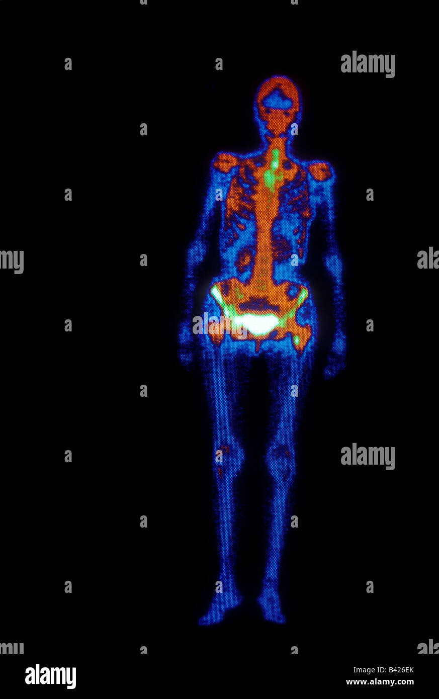 human body diagnostic imaging Stock Photo - Alamy