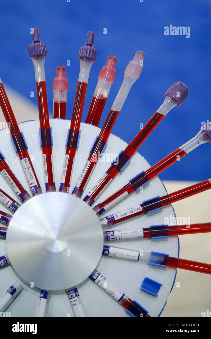 The erythrocyte sedimentation rate (ESR) test Stock Photo - Alamy