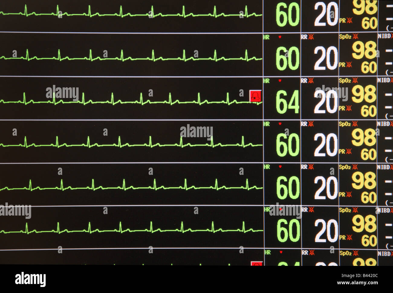 Medical monitor hi-res stock photography and images - Alamy
