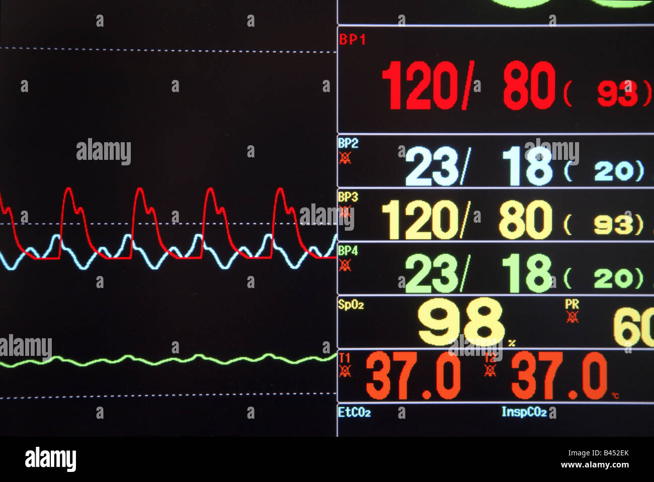 A medical monitor Stock Photo - Alamy