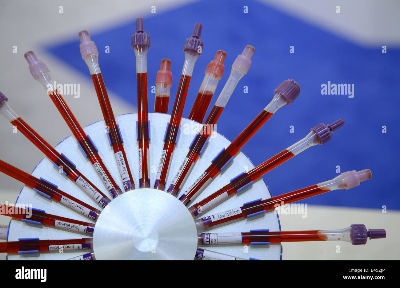 The erythrocyte sedimentation rate (ESR) test Stock Photo - Alamy