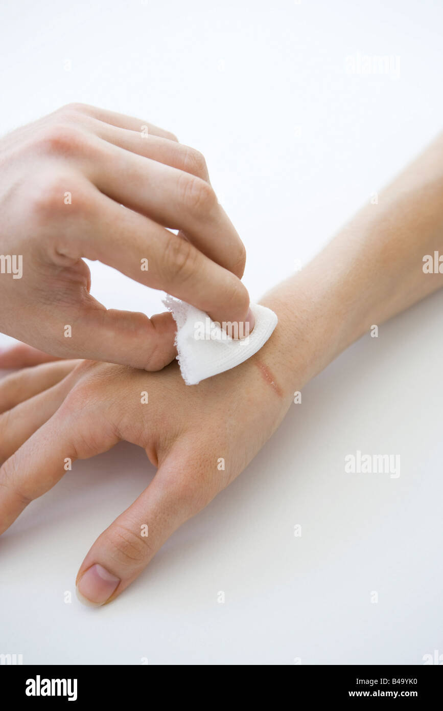 Person holding gauze against wounded hand, cropped view Stock Photo - Alamy