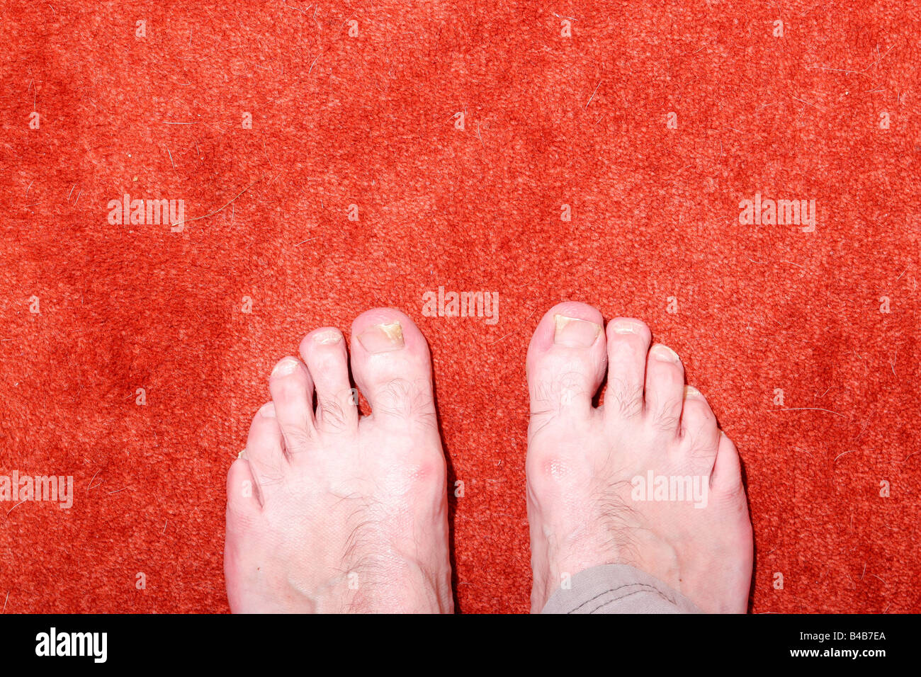 Mans feet and toes Stock Photo - Alamy