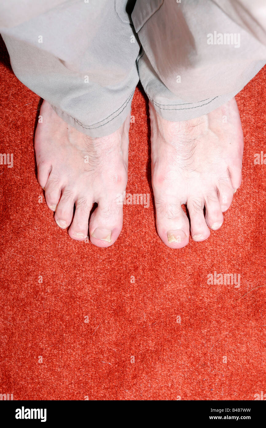 Mans feet and toes Stock Photo - Alamy