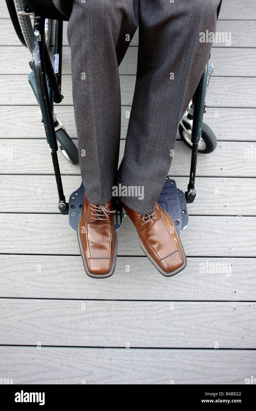 Crippled legs and feet hi-res stock photography and images - Alamy