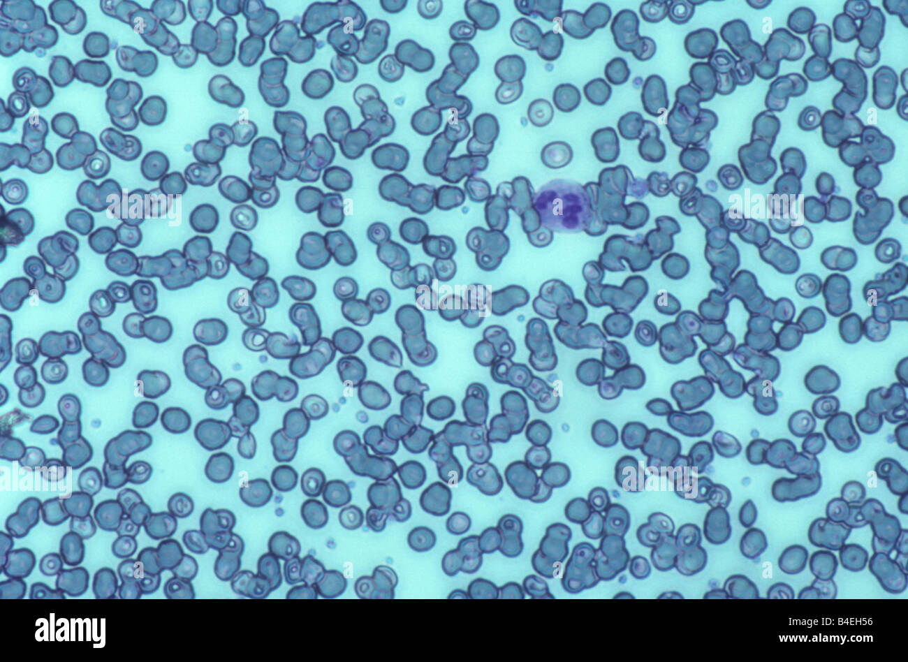 Blood platelets hi-res stock photography and images - Alamy