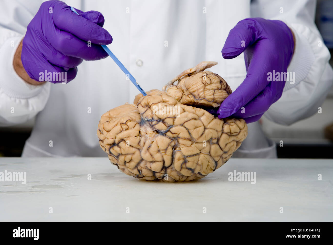 Real human brain laboratory hi-res stock photography and images - Alamy
