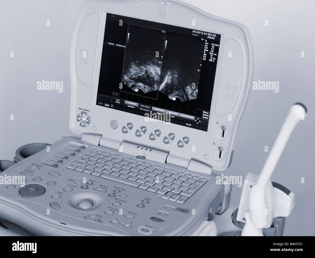 Ultrasound machine hi-res stock photography and images - Alamy