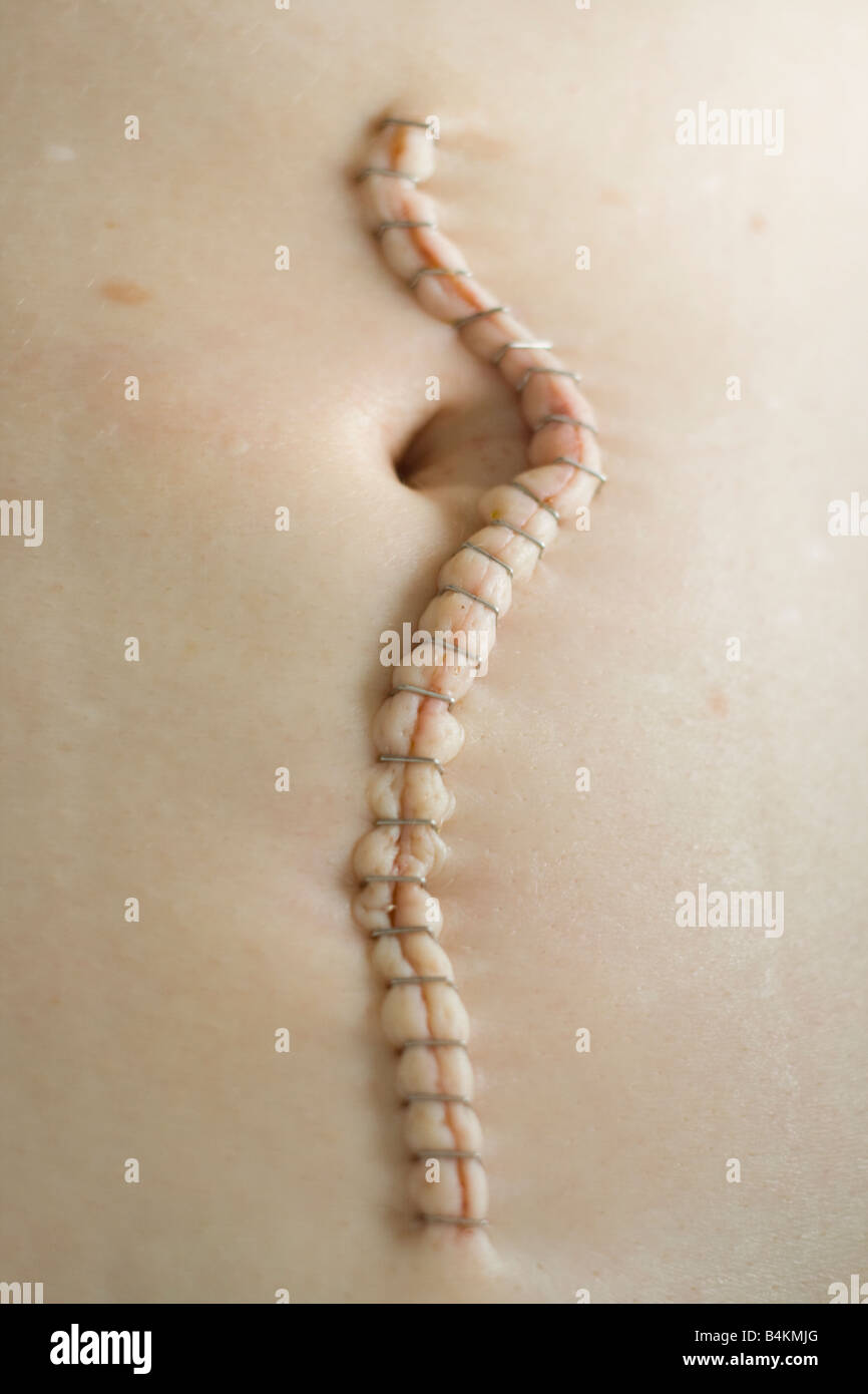 Stock Photography Of Staples K5637440 Search Stock