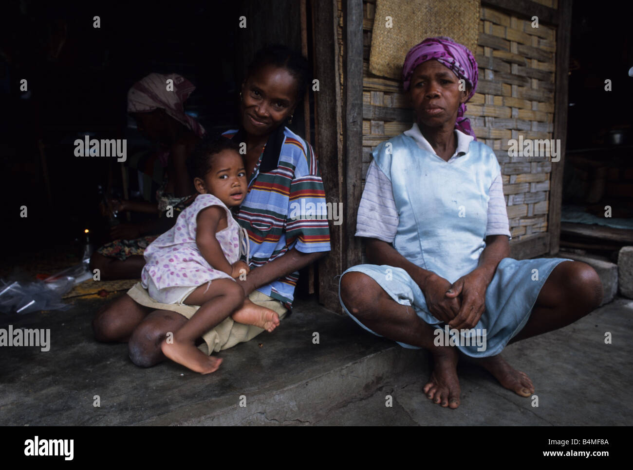Leprosy child hi-res stock photography and images - Alamy