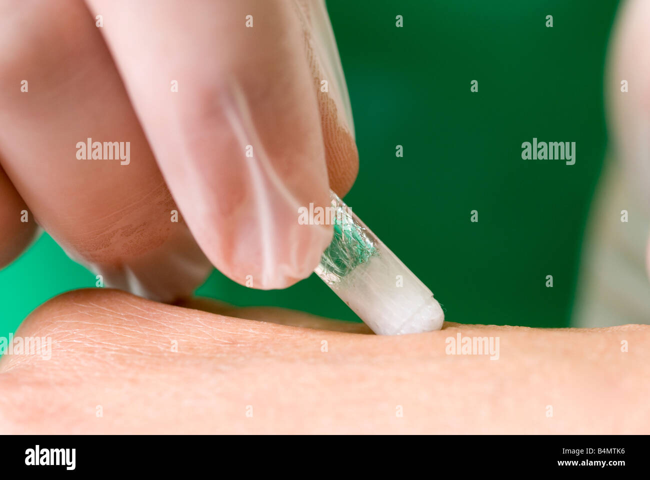 Cannula arm hi-res stock photography and images - Alamy