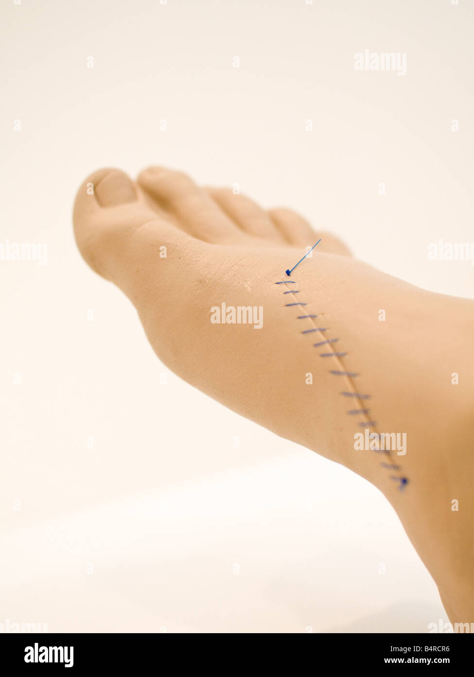 Foot stitches hi-res stock photography and images - Alamy