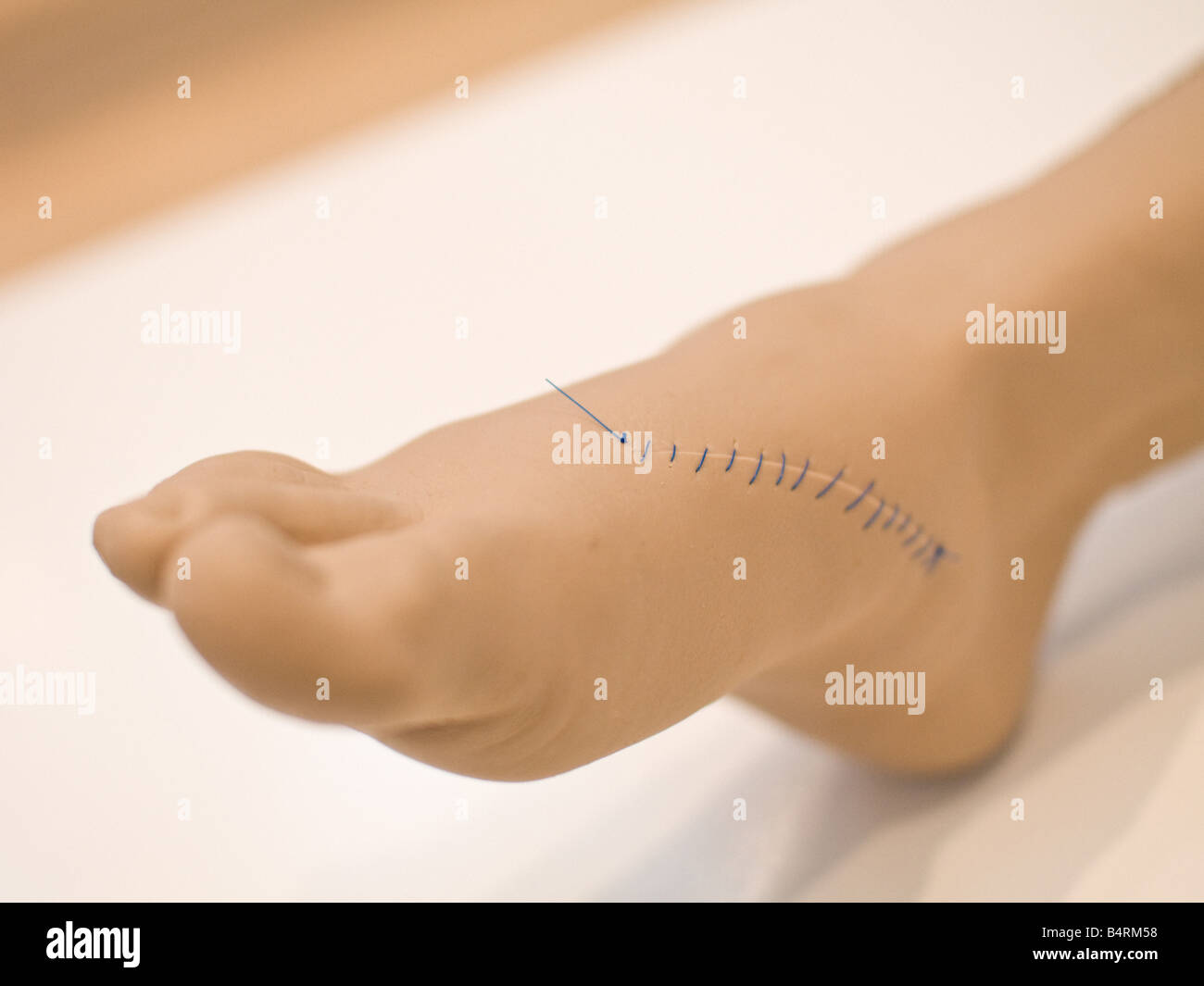 Prosthetic foot hi-res stock photography and images - Alamy