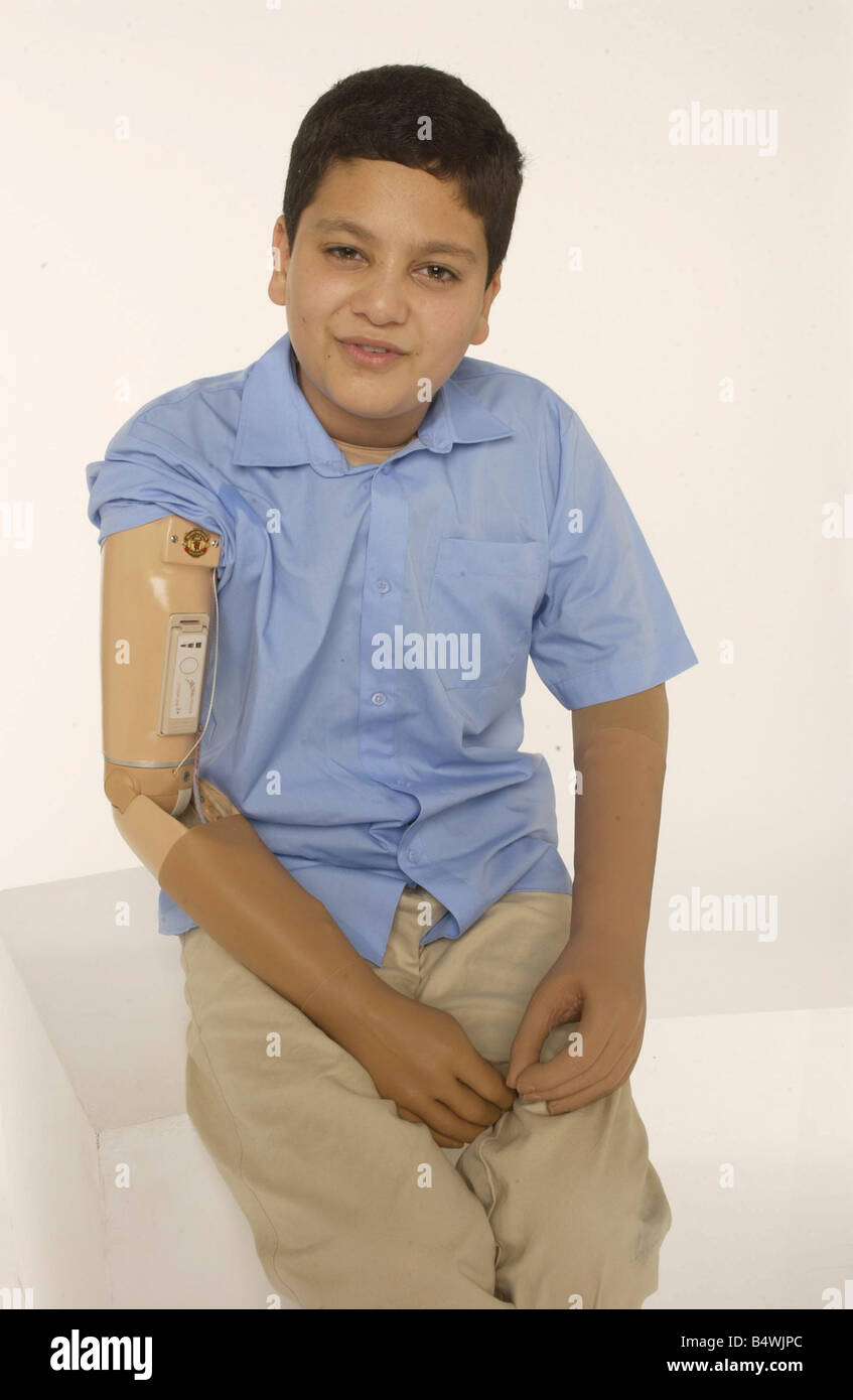 Ali abbas who lost arms hi-res stock photography and images - Alamy