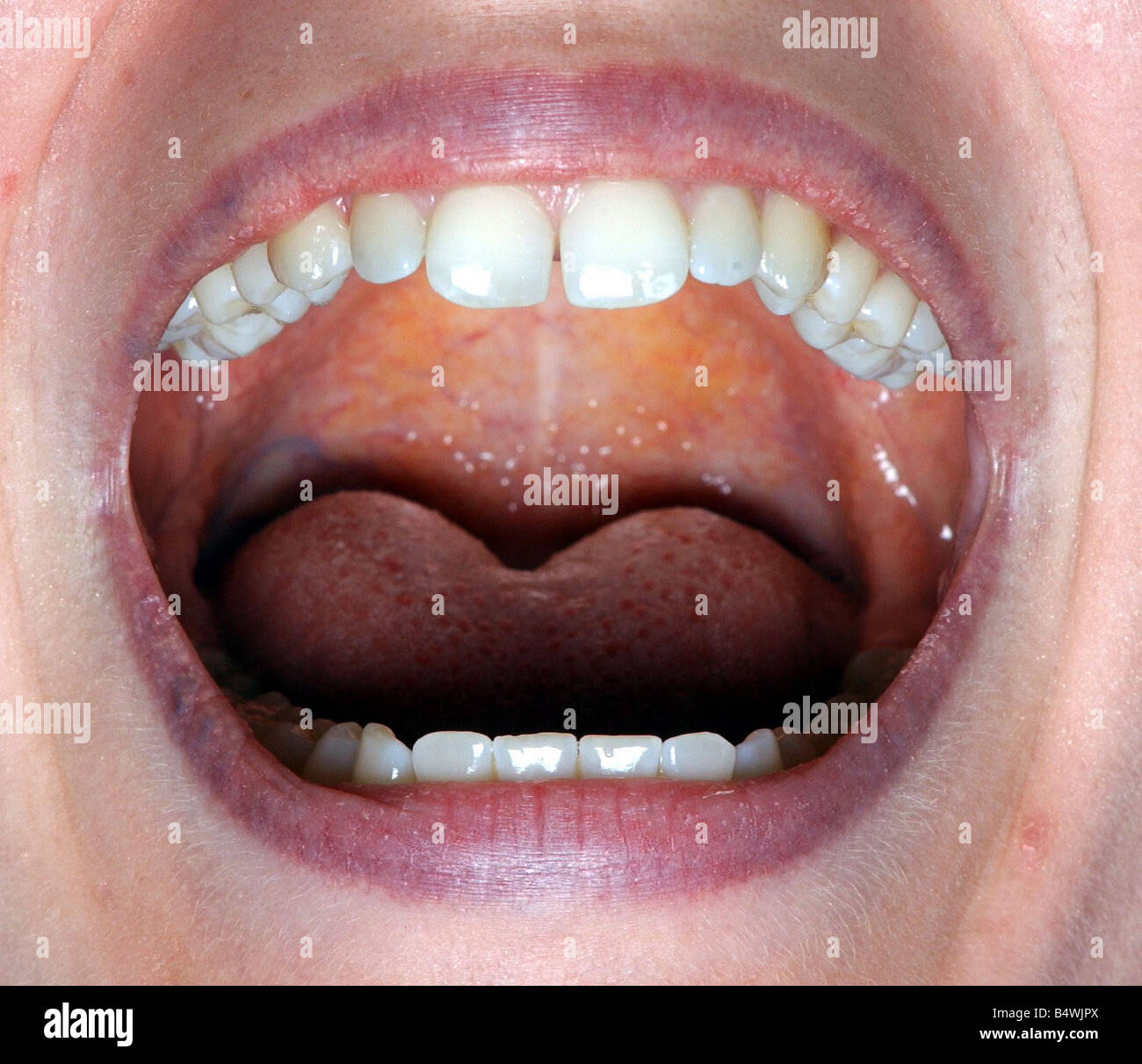 A picture to illustrate Dentists showing a open mouth Stock Photo - Alamy
