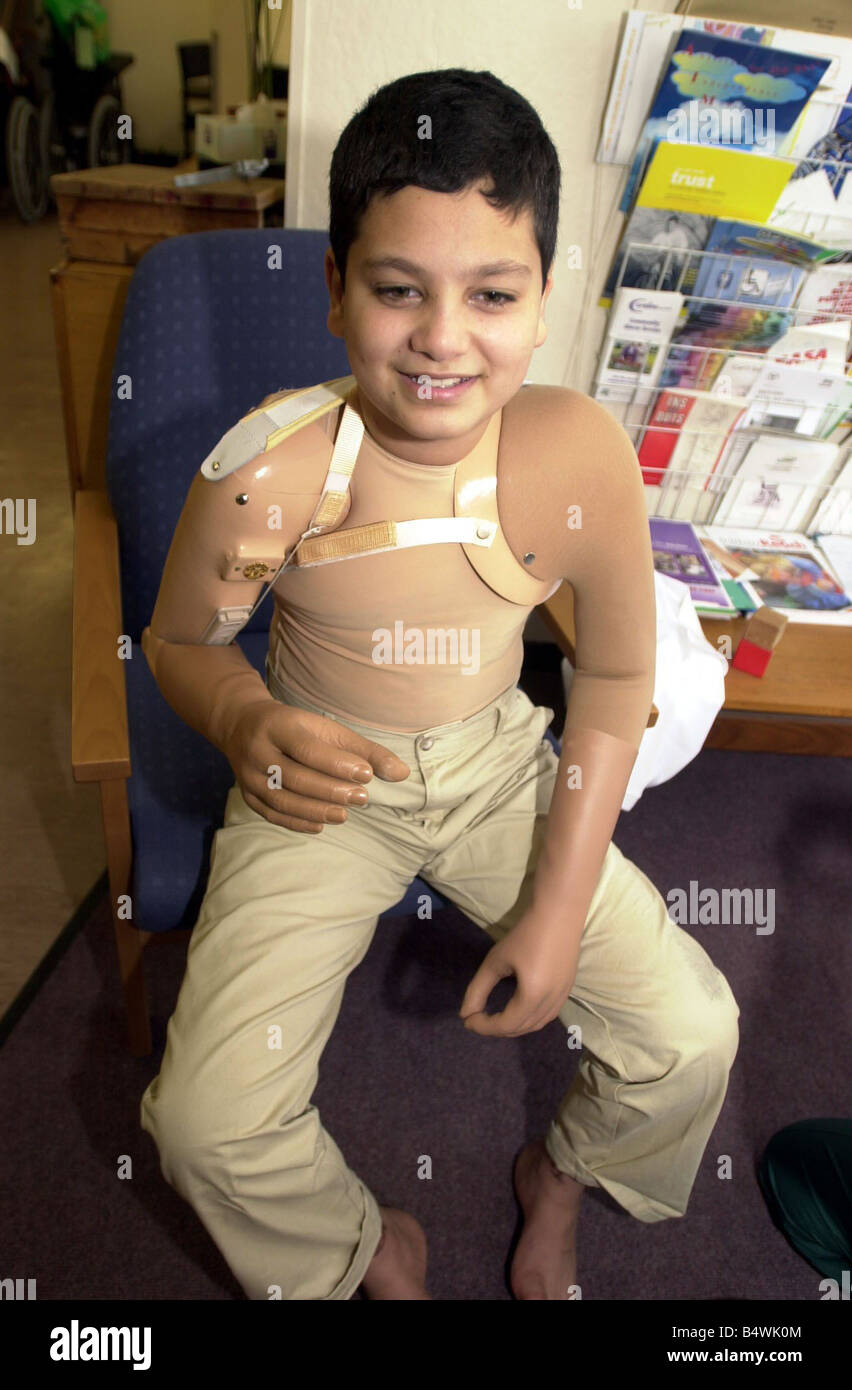 Ali Abbas who lost both arms and suffered terrible burns during the ...