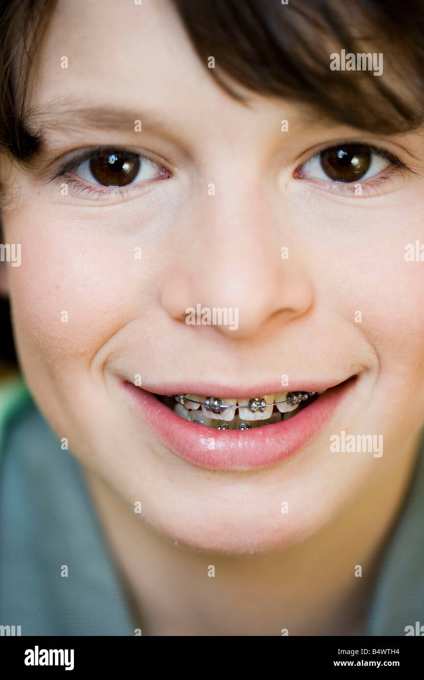 Portrait boy with brace Stock Photo - Alamy