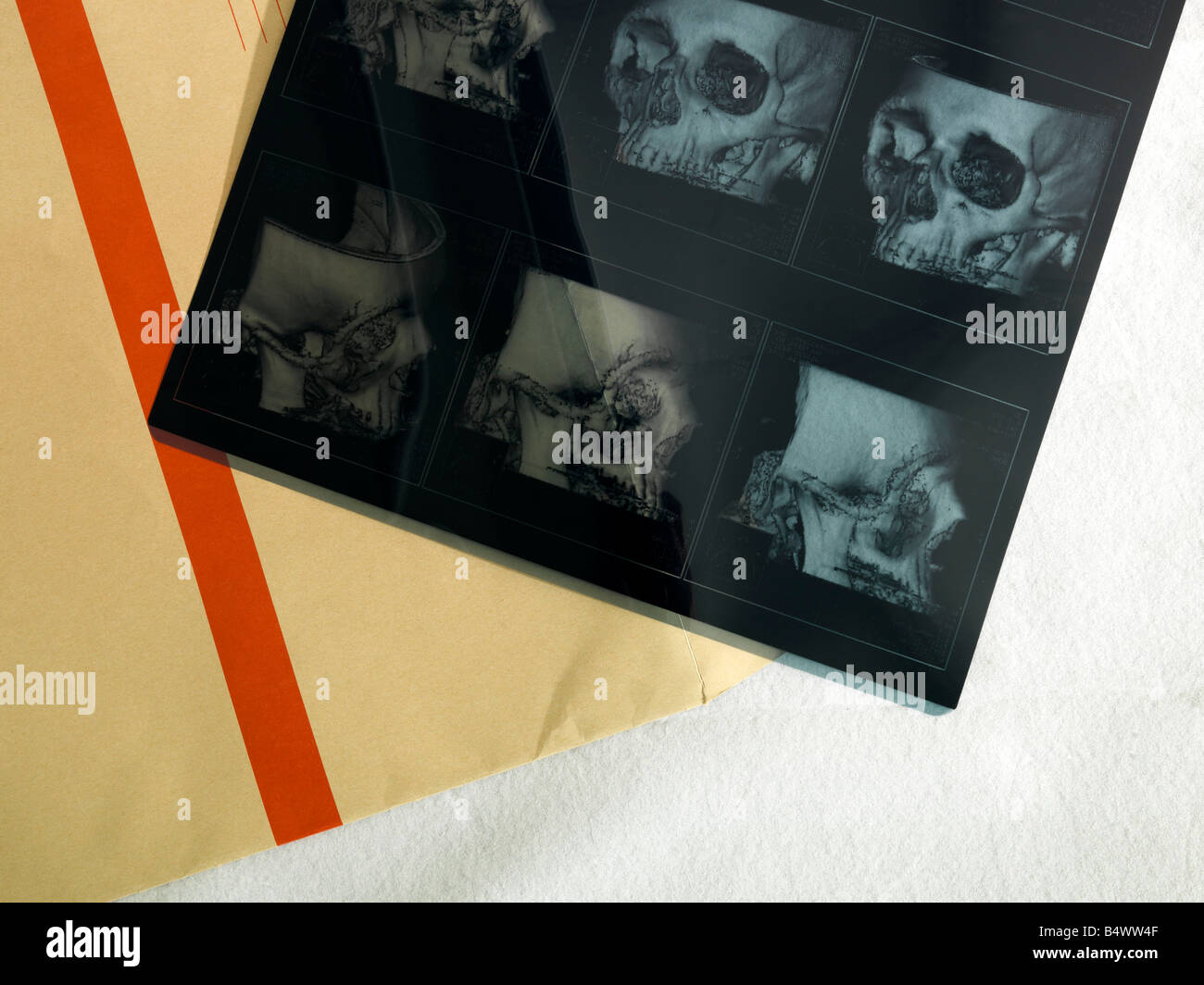 X-ray and envelope Stock Photo - Alamy