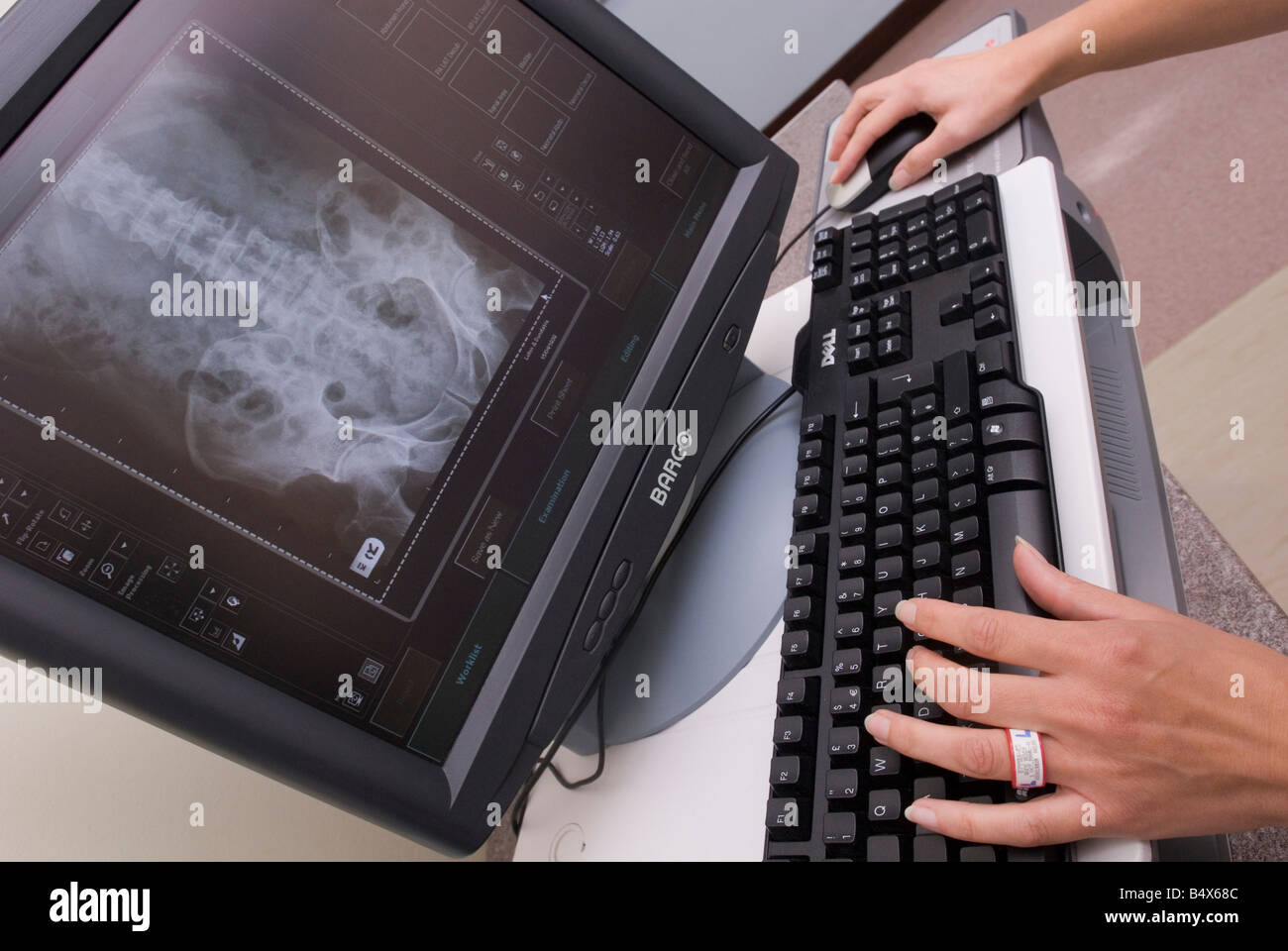 A radiographer uses a computer to look at an xray in a hospital Stock ...