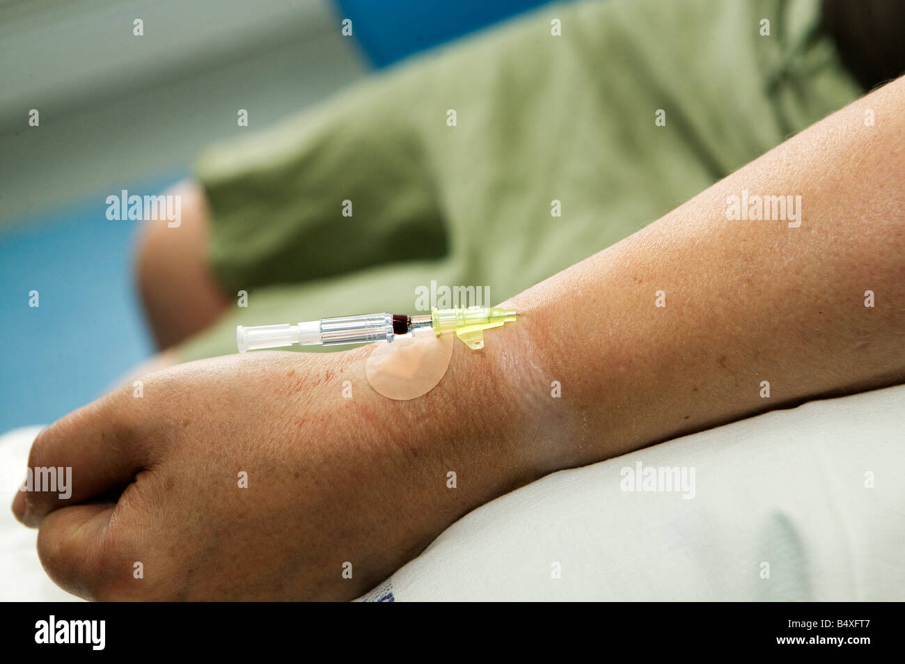 Close up of a cannula in a cancer patient's arm Stock Photo - Alamy