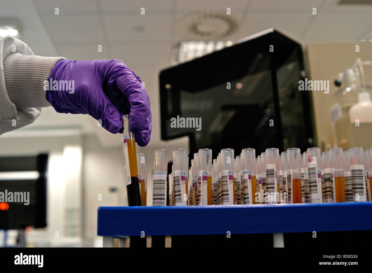Blood is prepared for screening in a National Blood Service laboratory ...