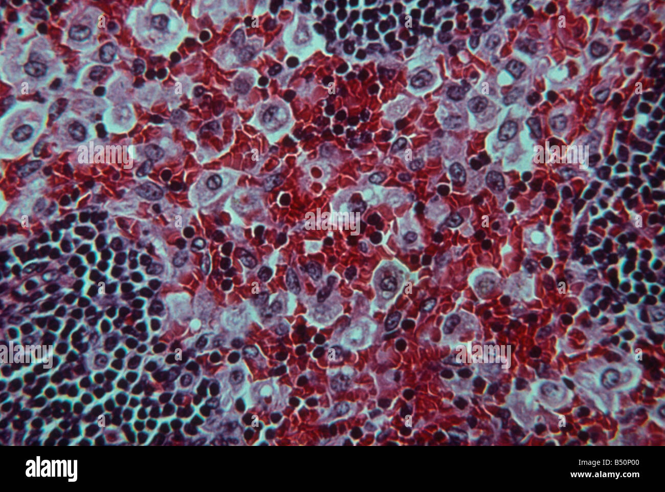 Kidney cells hi-res stock photography and images - Alamy
