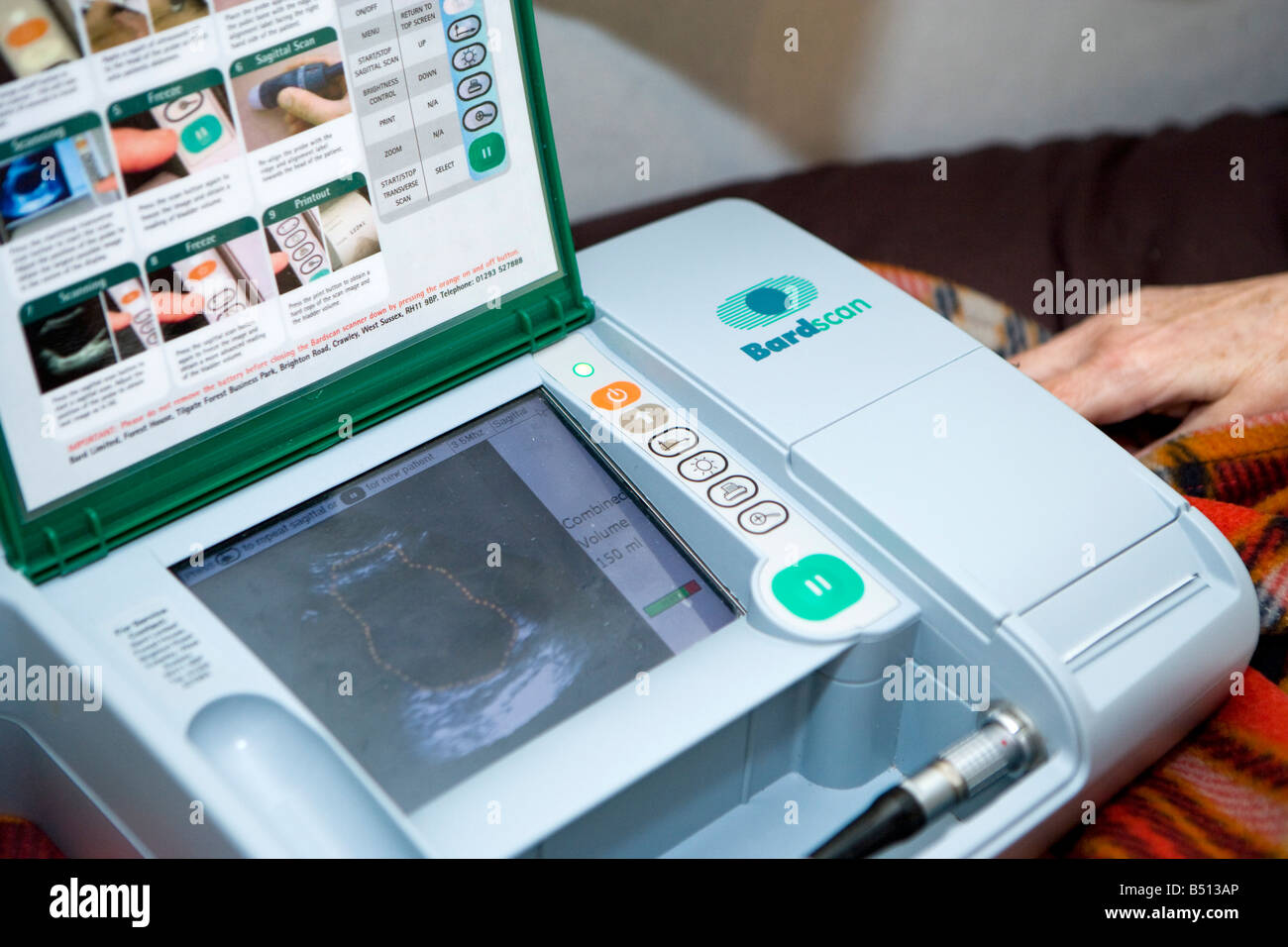 portable bladder ultrasound machine being used by a district nurse in a ...
