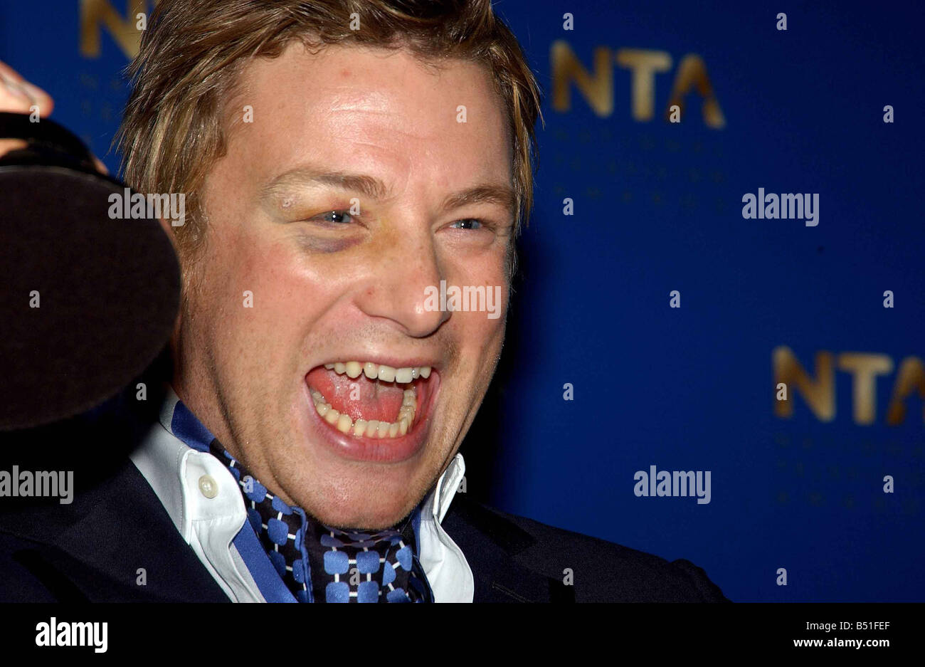 Injured celebrities hi-res stock photography and images - Alamy