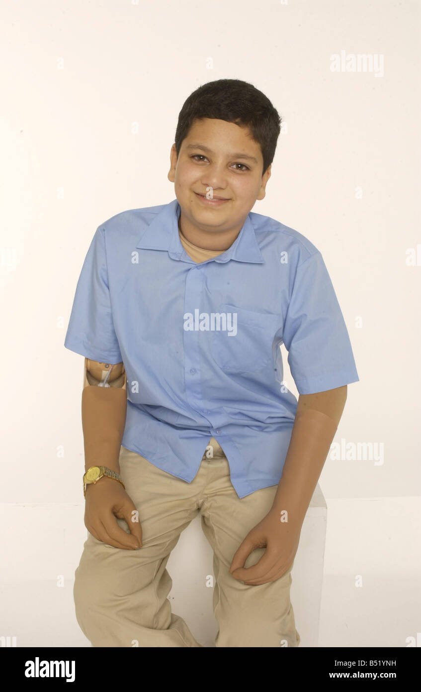 Ali abbas who lost arms hi-res stock photography and images - Alamy