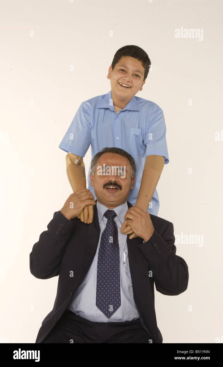 Ali Abbas who lost both arms and suffered terrible burns during the ...