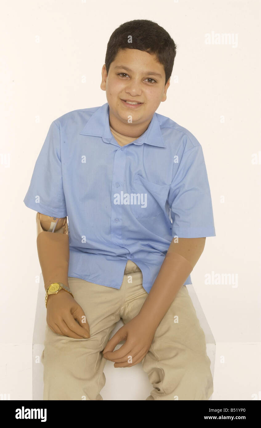 Ali abbas who lost arms hi-res stock photography and images - Alamy