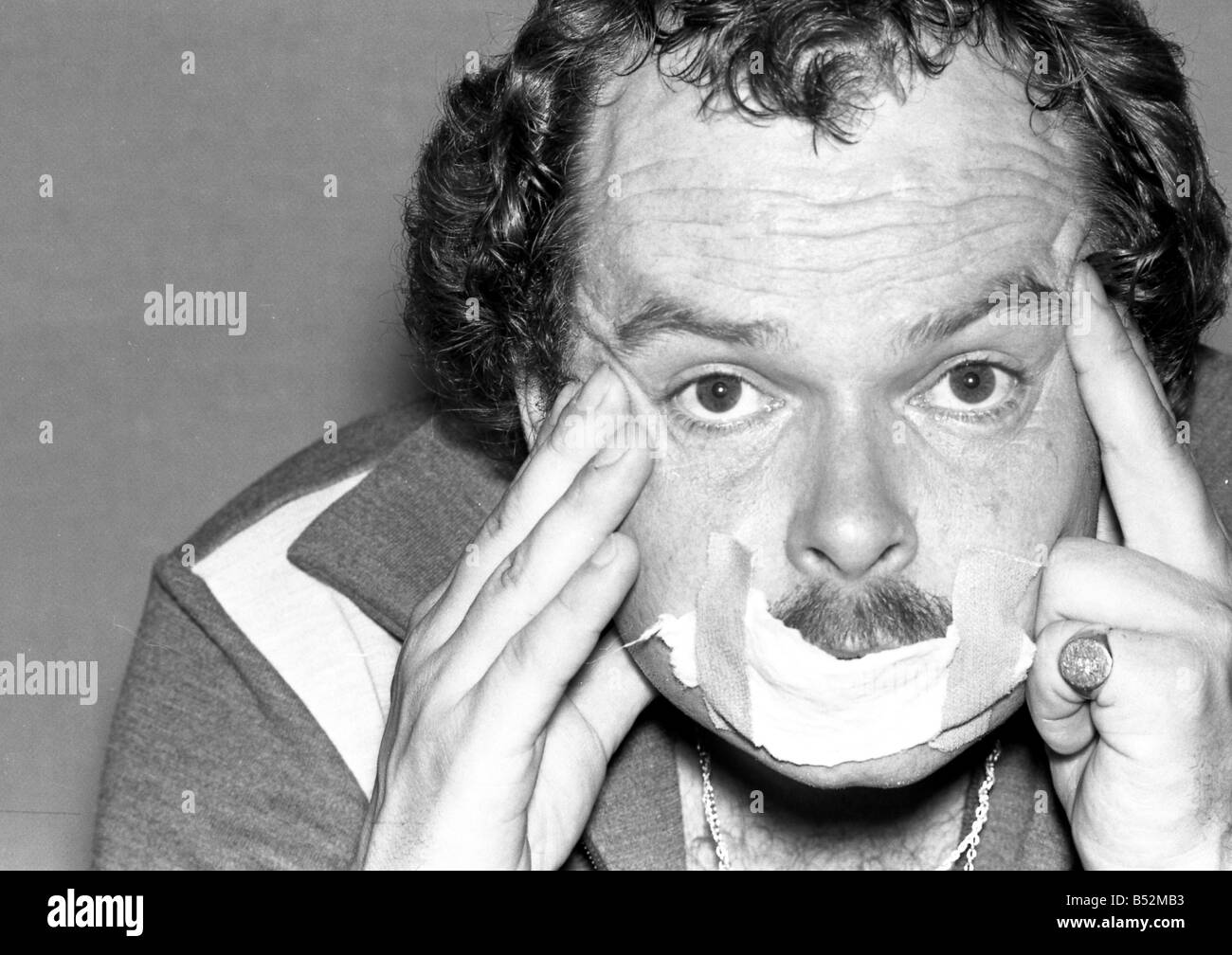 Whale lips hi-res stock photography and images - Alamy