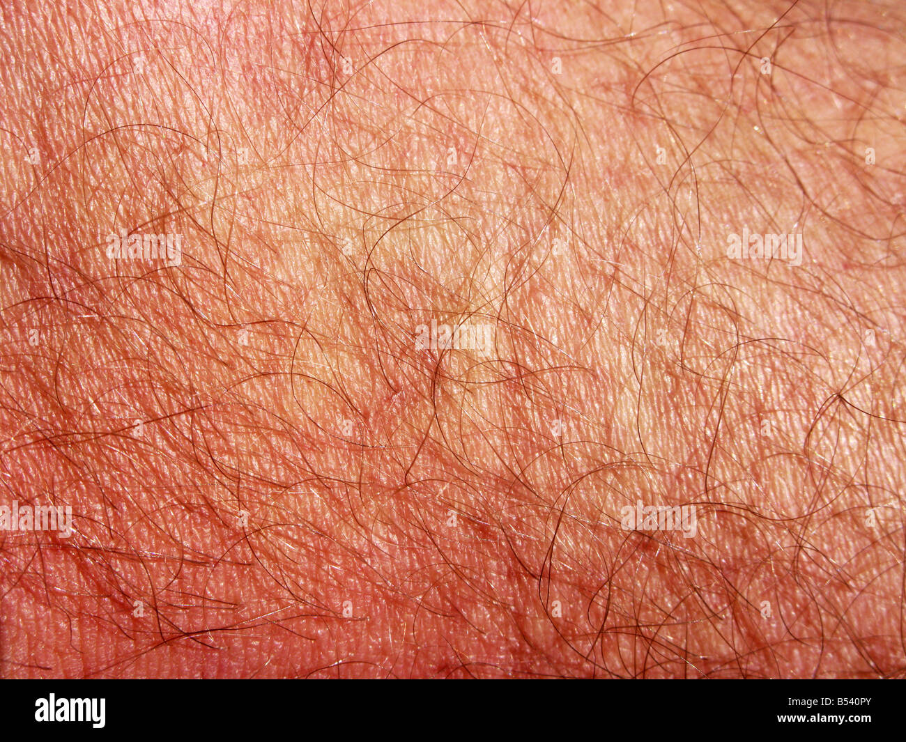 Close up of skin surface Stock Photo - Alamy