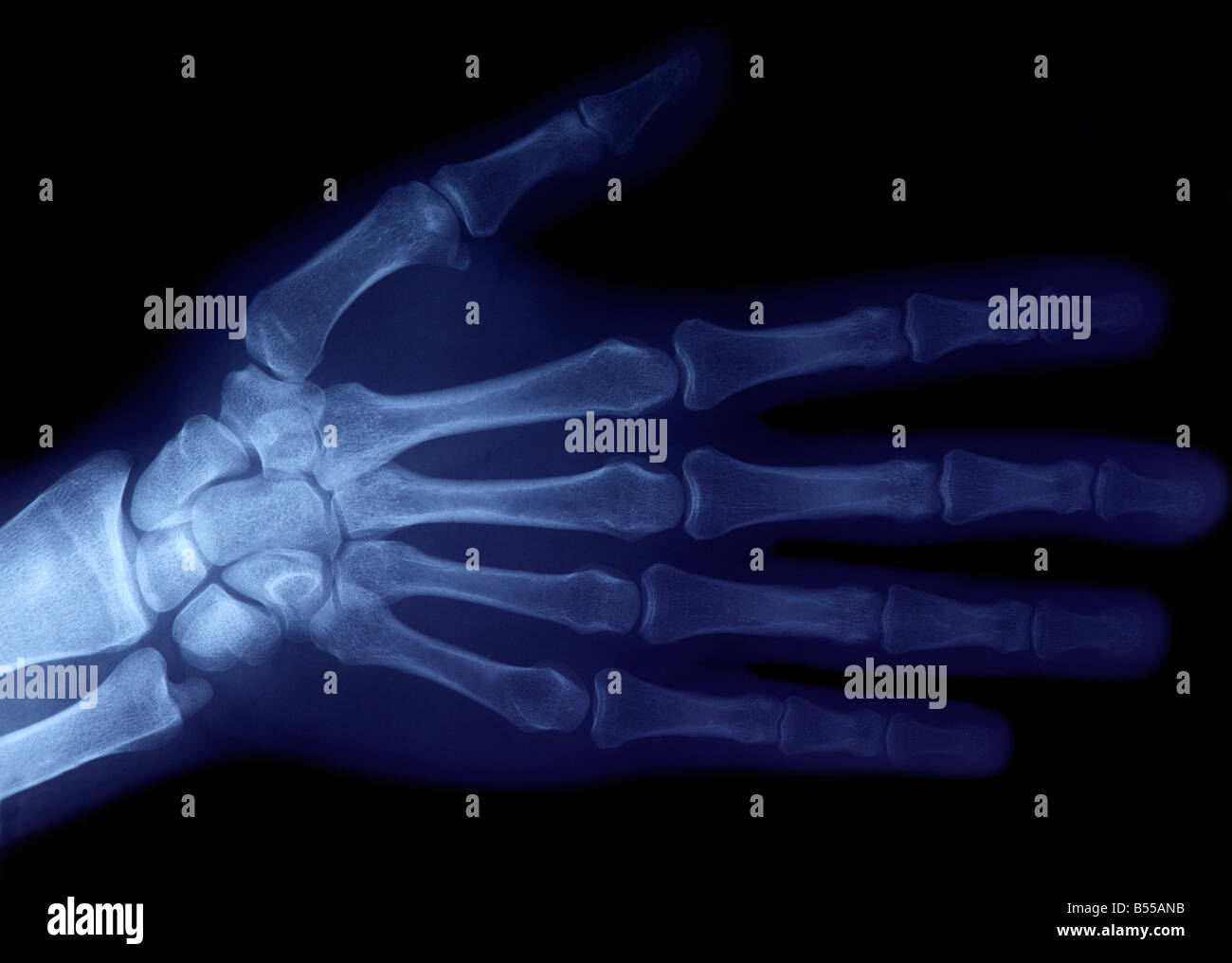 Hand anatomy photo hi-res stock photography and images - Alamy