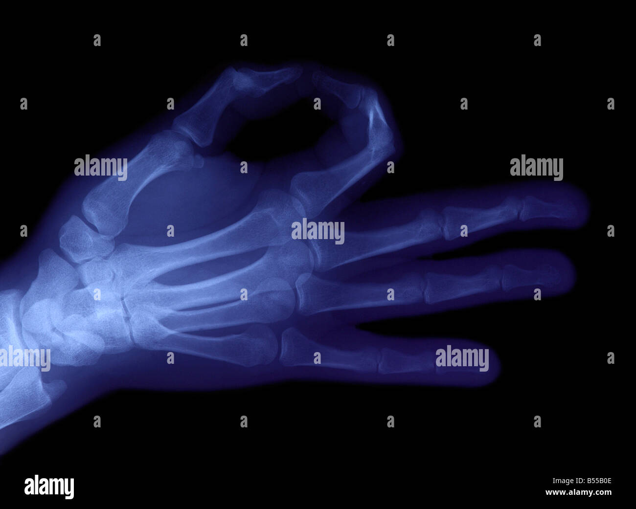 Hand anatomy photo hi-res stock photography and images - Alamy