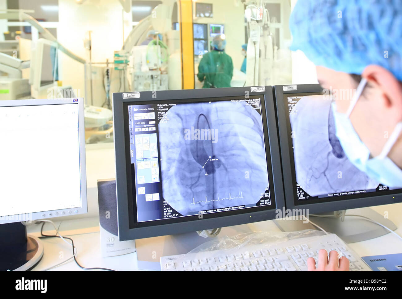 Doctor looking at a computer monitor during heart operation Stock Photo ...