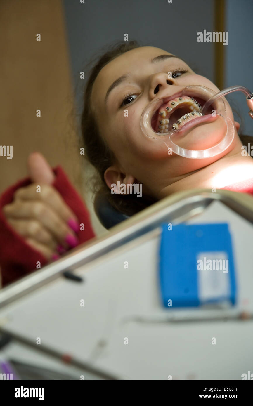 Smiling Teen Girl At Orthodontic Treatment Having Braces Mounted on ...